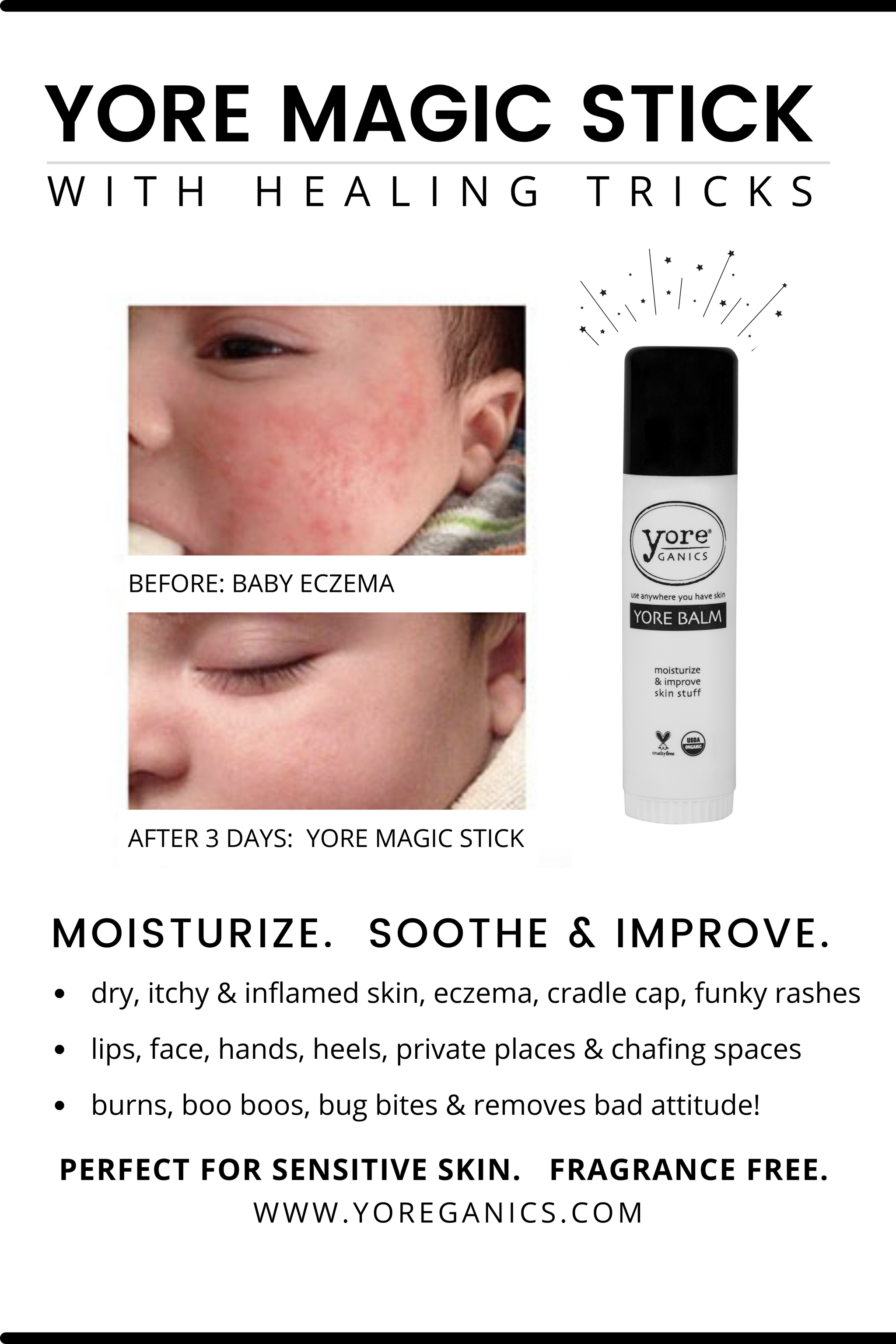 yore skin starter kit – yoreganics